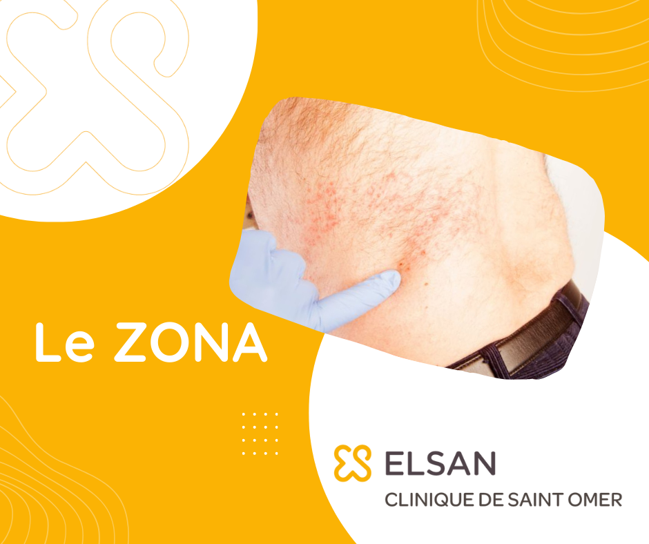 "Le Zona" explication avec le Dr Géraldine Jonniaux | Elsan